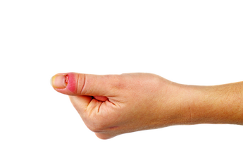 Zastrzał palca, zastrzał paznokcia – czy jest niebezpieczny, jaka maść ...