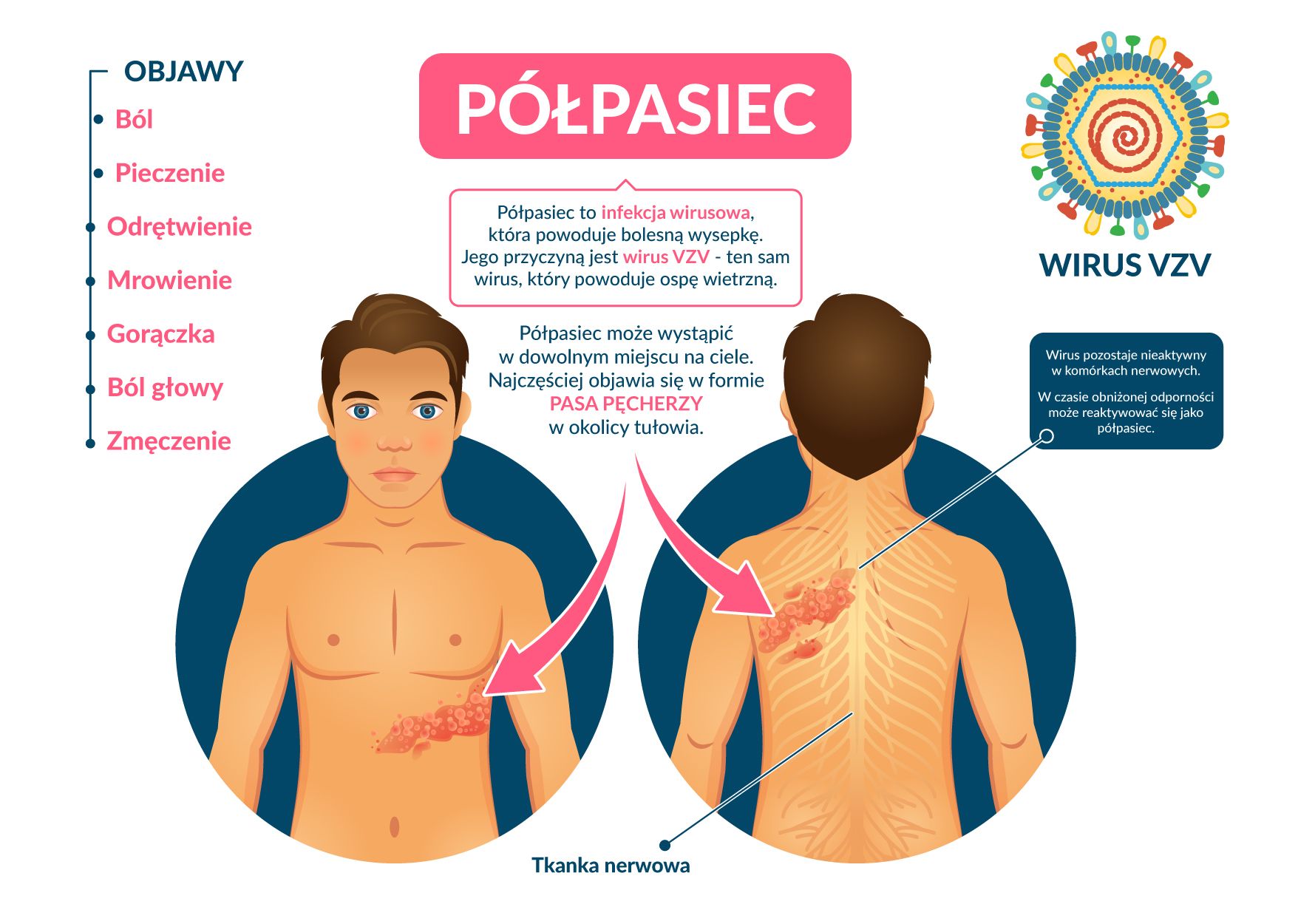 Półpasiec – objawy, leczenie. Jak boli półpasiec, czy jest zaraźliwy ...
