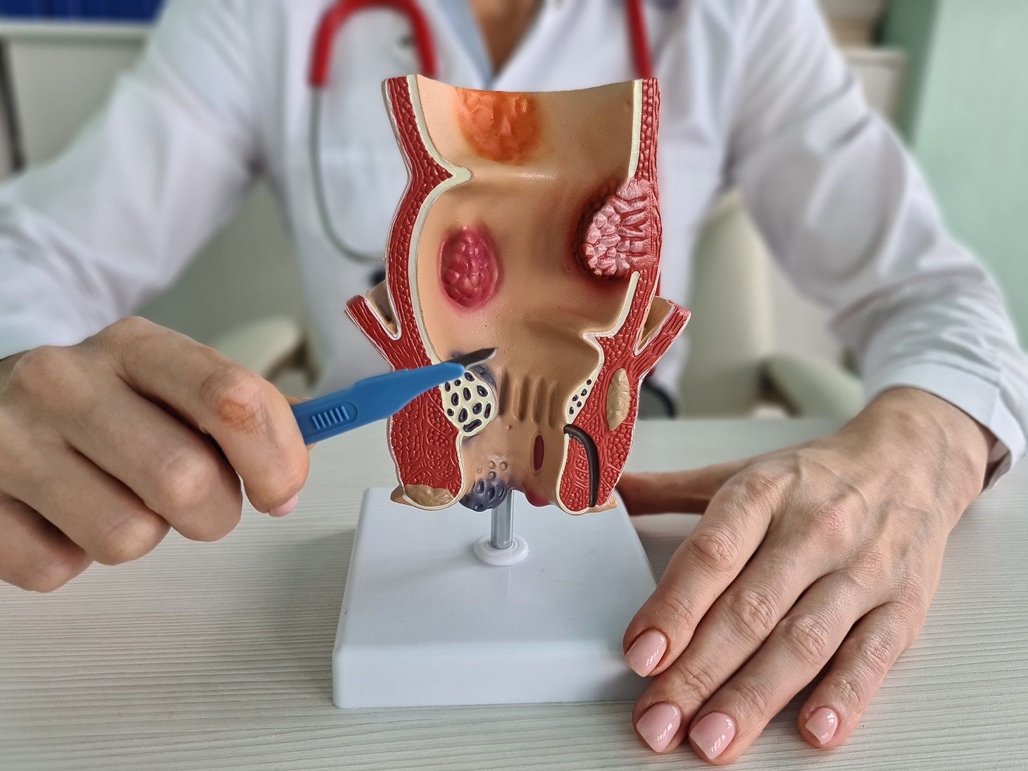 Badanie prostaty. Jak się bada prostatę? Jak wygląda badanie prostaty ...